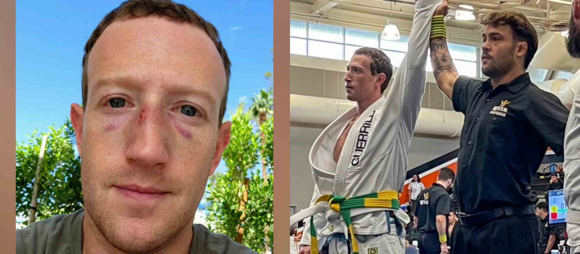 Mark Zuckerberg showcases two shiners he proudly earned in an MMA class